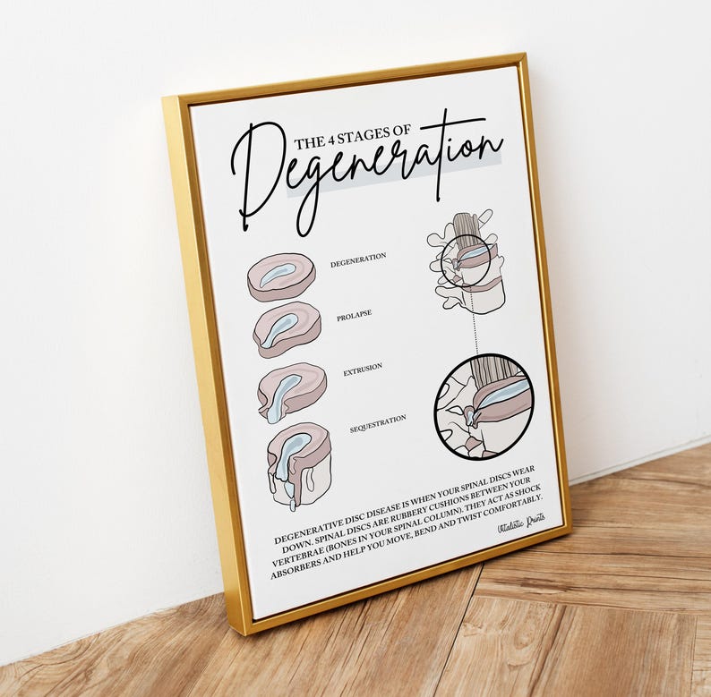 The 4 Stages of Degeneration Print // Spinal Nerve Chart ...
