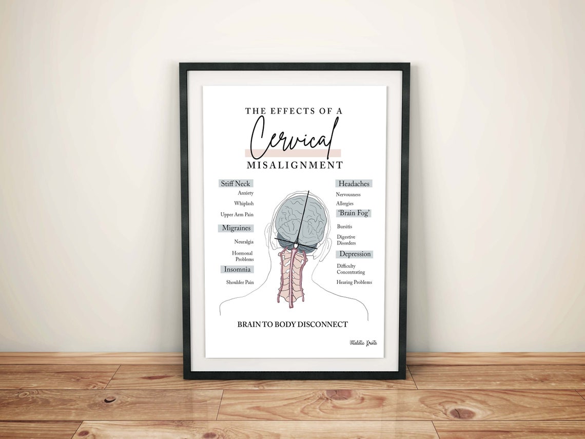Cervical Misalignment Print // Body Imbalance Print // Spinal Nerve ...