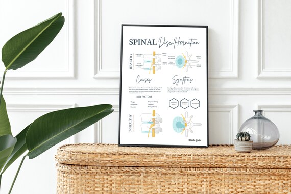 Spinal Disc Herniation Print // Intervertebral Disc Print // | Etsy