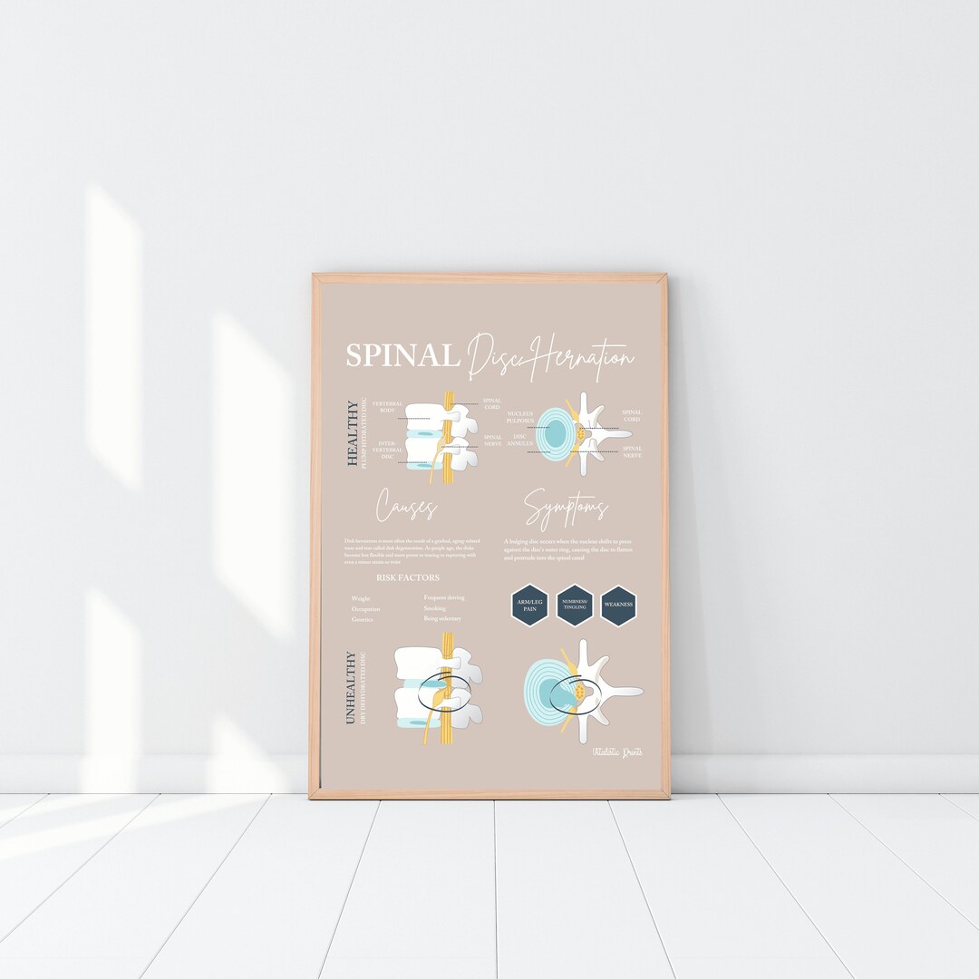 Spinal Disc Herniation Print // Intervertebral Disc Print // - Etsy
