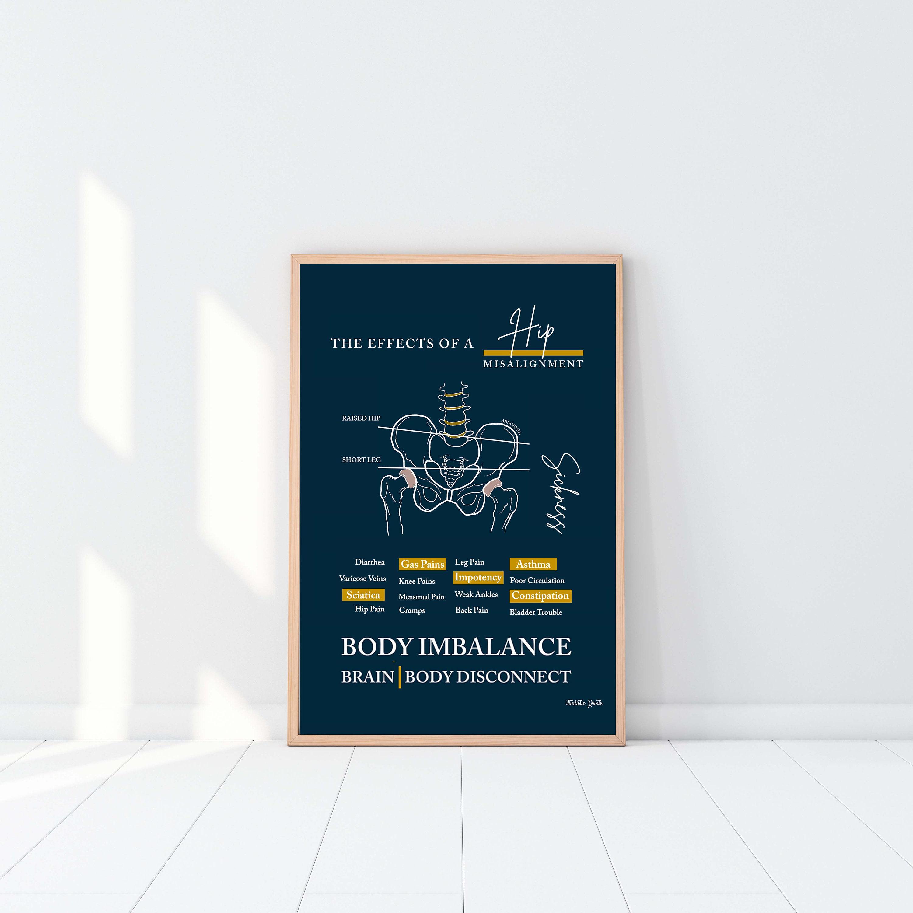 Hip Misalignment Print // Spinal Nerve Chart // Chiropractic ...