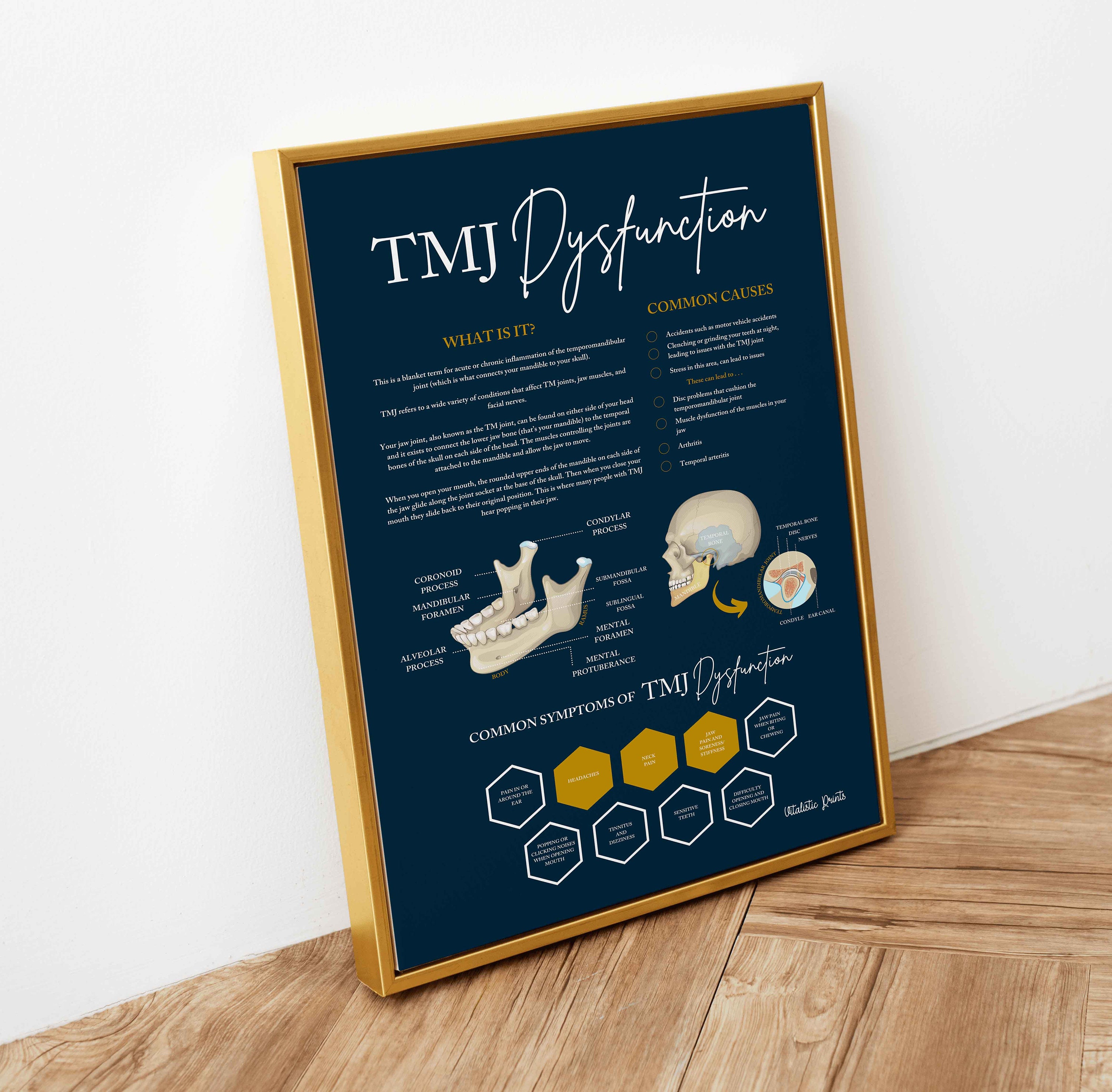 TMJ Dysfunction // Chiropractic // Jaw Pain // Subluxation // - Etsy