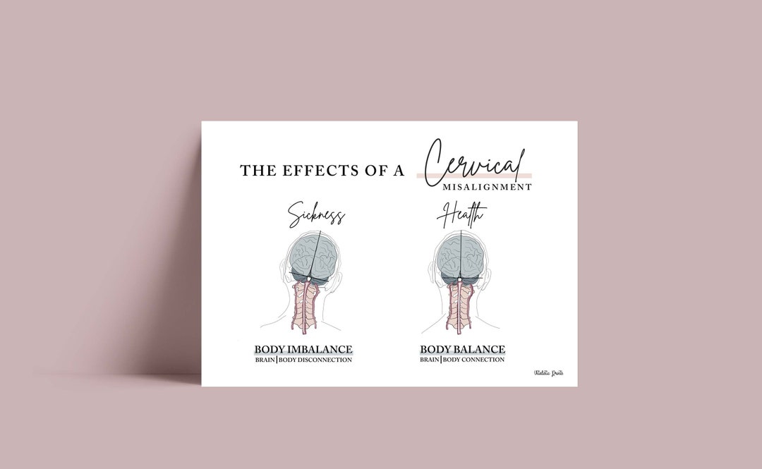 Cervical Misalignment Print // Body Imbalance Print // Spinal - Etsy