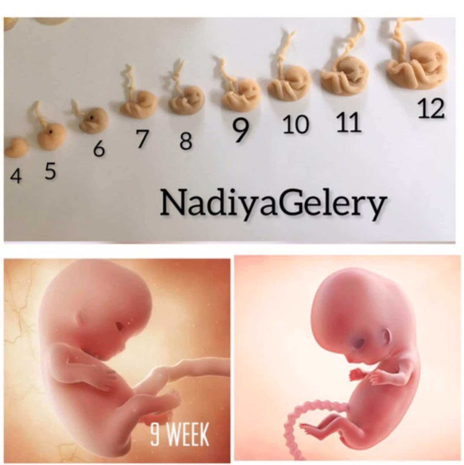 Embryo 10 Weeksloss Babymade to Order10weeks Gestation - Etsy