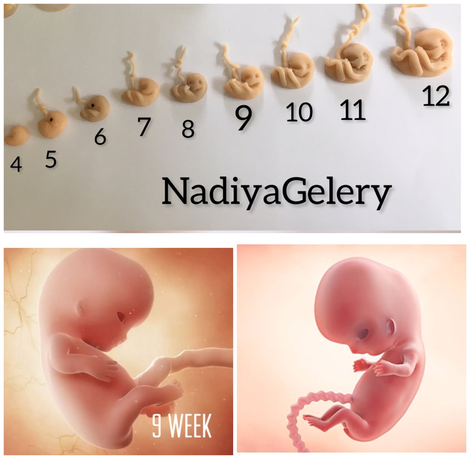 Embryo 7-8-9 Weeks miscarriage Ornament8 10 Weeks Fetus - Etsy