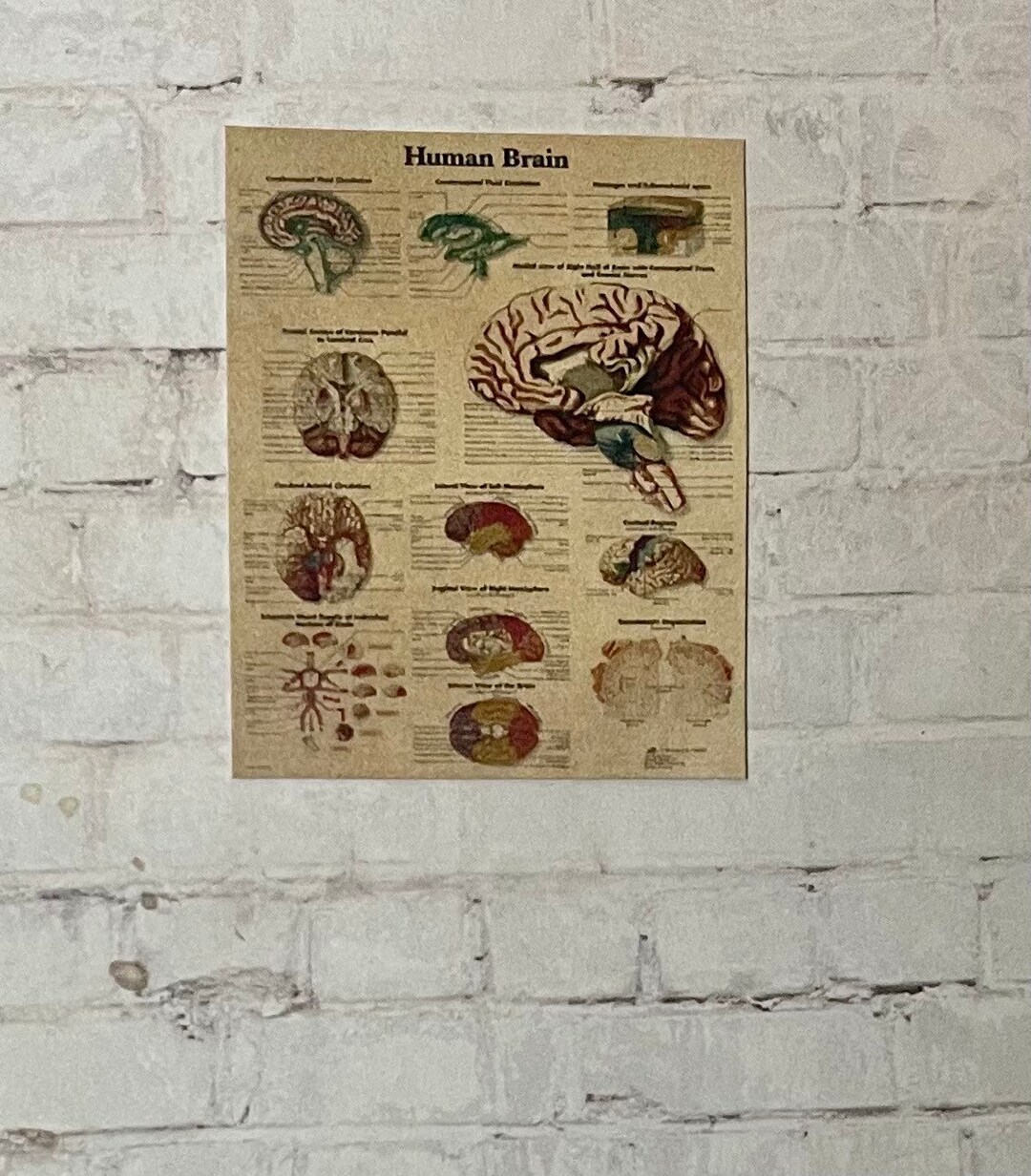Brain Medical Chart/poster for Asylum Hospital or Doctors - Etsy