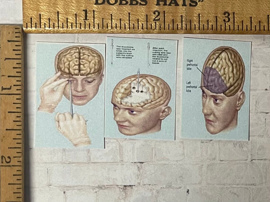 3 Pc Asylum Lobotomy Medical Charts/posters This is NOT Life - Etsy