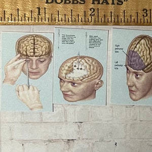 3 Pc Asylum Lobotomy Medical Charts/posters - This is NOT Life Size. - Etsy
