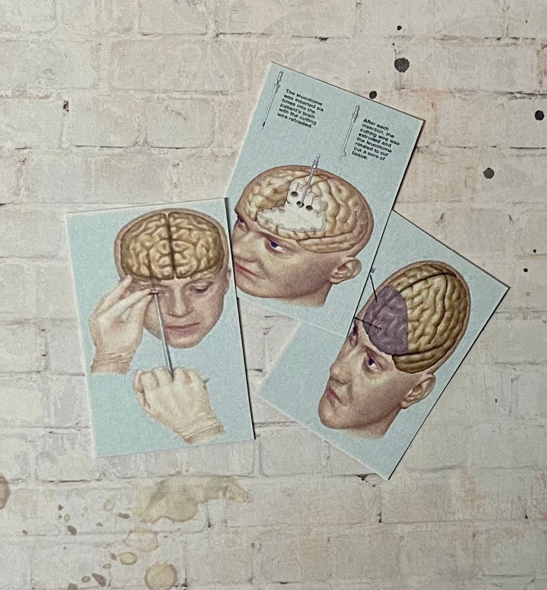 3 Pc Asylum Lobotomy Medical Charts/posters - This is NOT Life Size. - Etsy