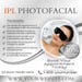 IPL Photofacial Flyer Template - Intense Pulsed Light Therapy Photo ...