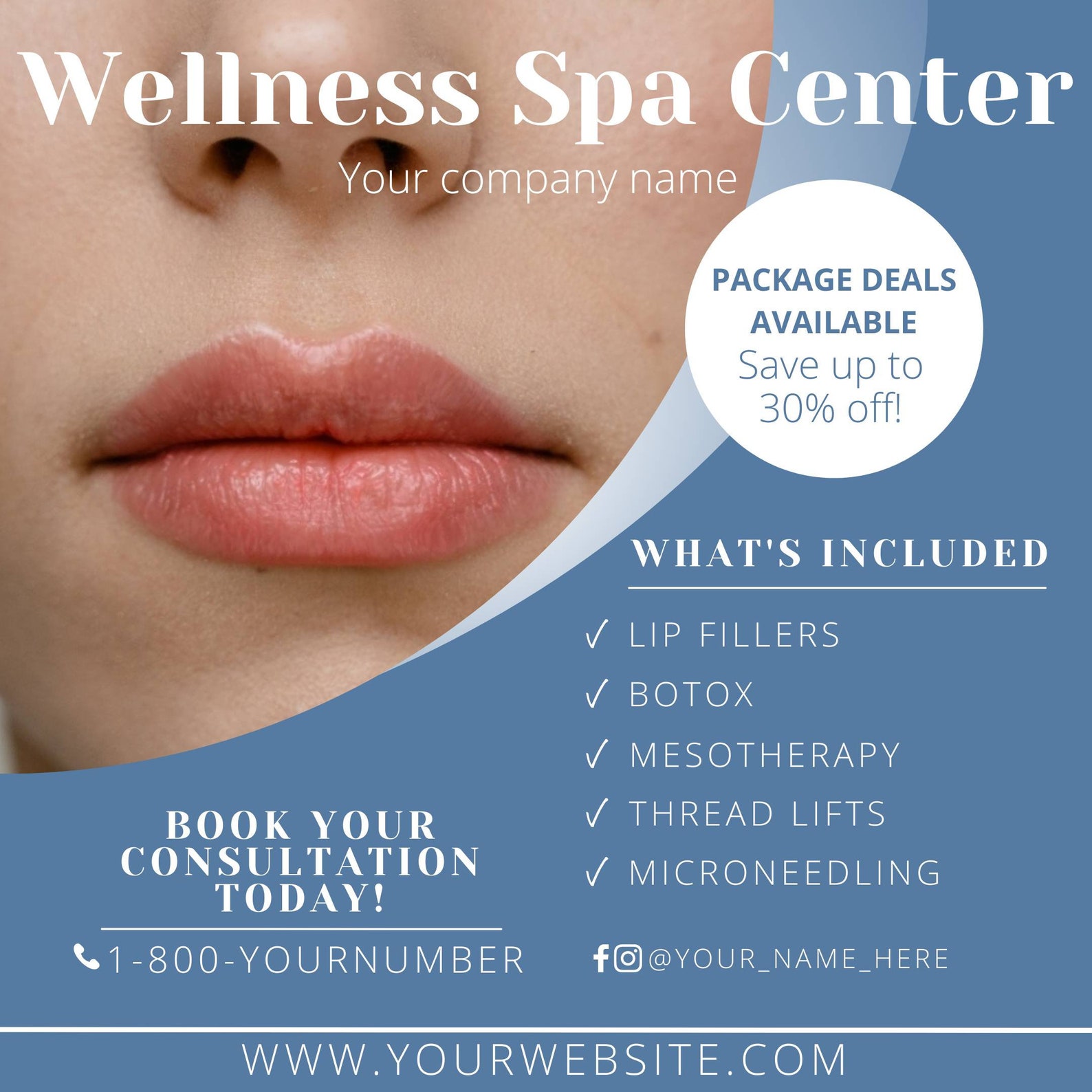 Med Spa Lip Fillers Flyer Template editable Instagram Lips - Etsy