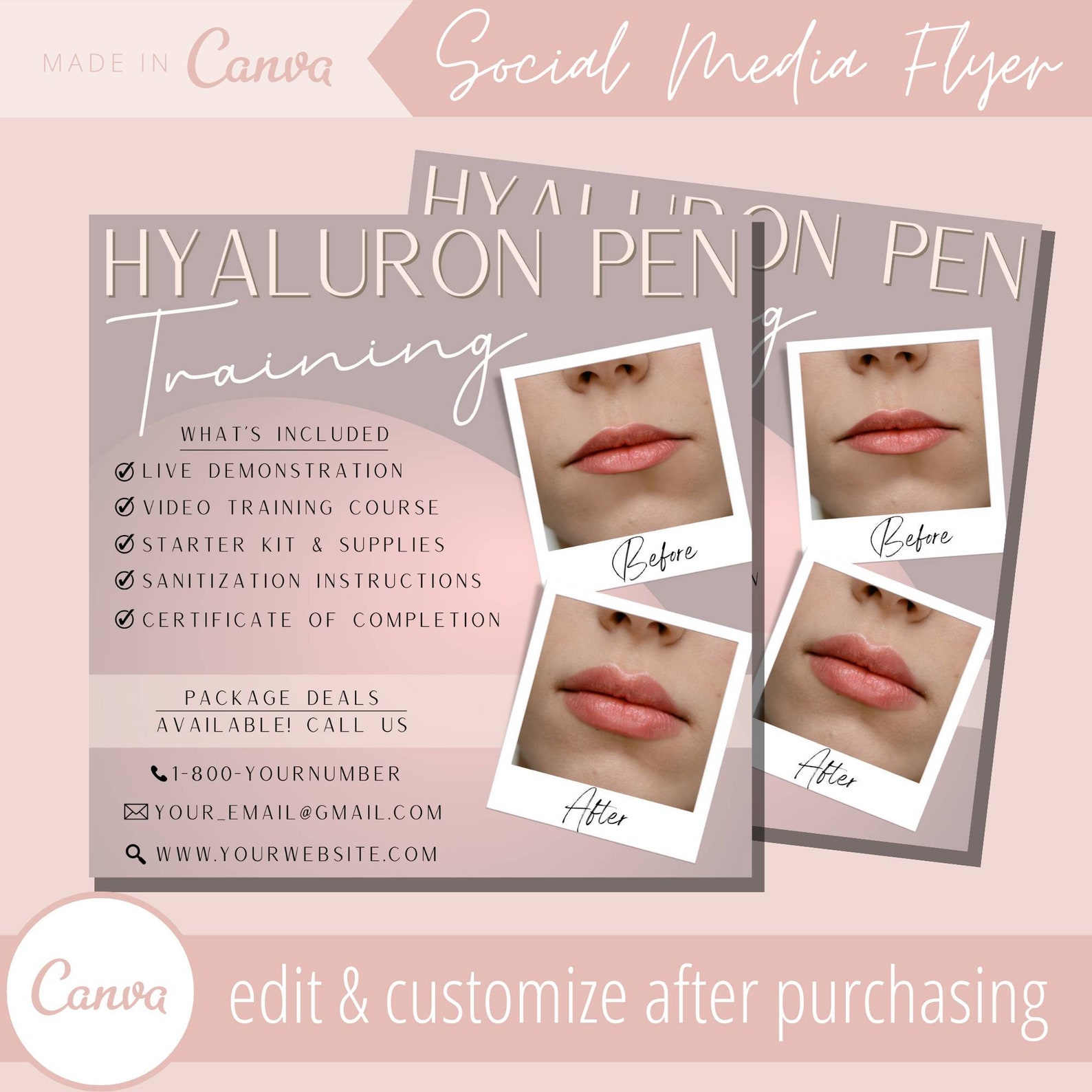 Hyaluron Pen Training Flyer Template - Lip Filler Injection Class ...