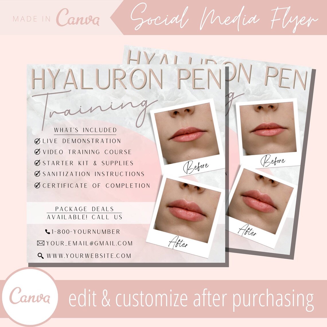 Hyaluron Pen Training Class Flyer Template -editable Instagram ...