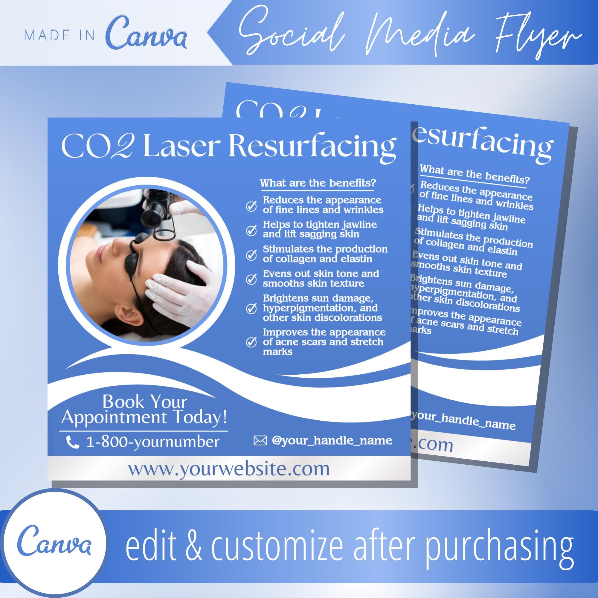 CO2 Laser Resurfacing Flyer Template - Carbon Dioxide Laser Skin ...