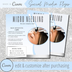 Microneedling Flyer Template Micro Needling Instagram Flyers | Etsy