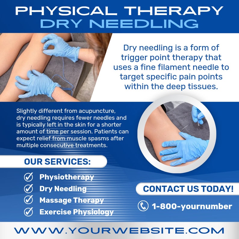 Dry Needling Therapy Flyer Template - Trigger-point Dry Needle ...