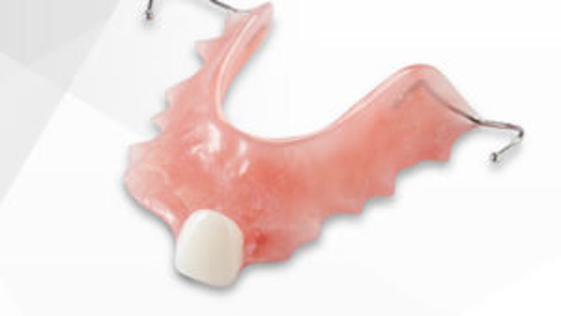 CUSTOM Partials Denture Teeth Missing False Tooth dental | Etsy