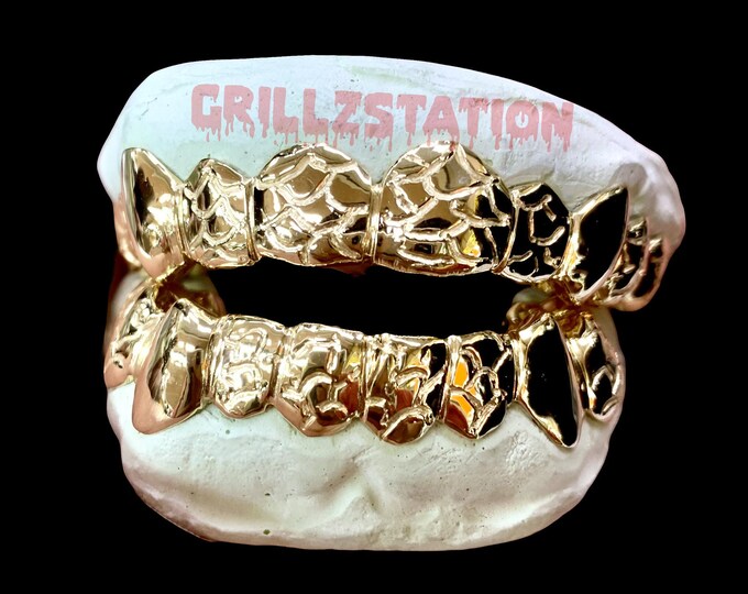 Custom Gold Grillz by GRILLZSTATION on Etsy