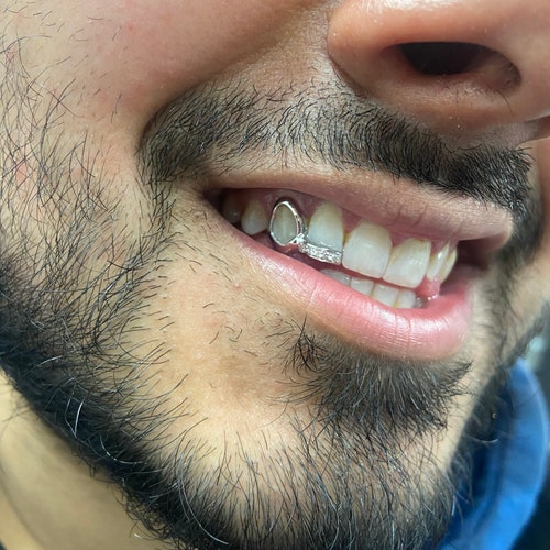 Double Window With Heart Grillz United Kingdom Custom Fitted - Etsy