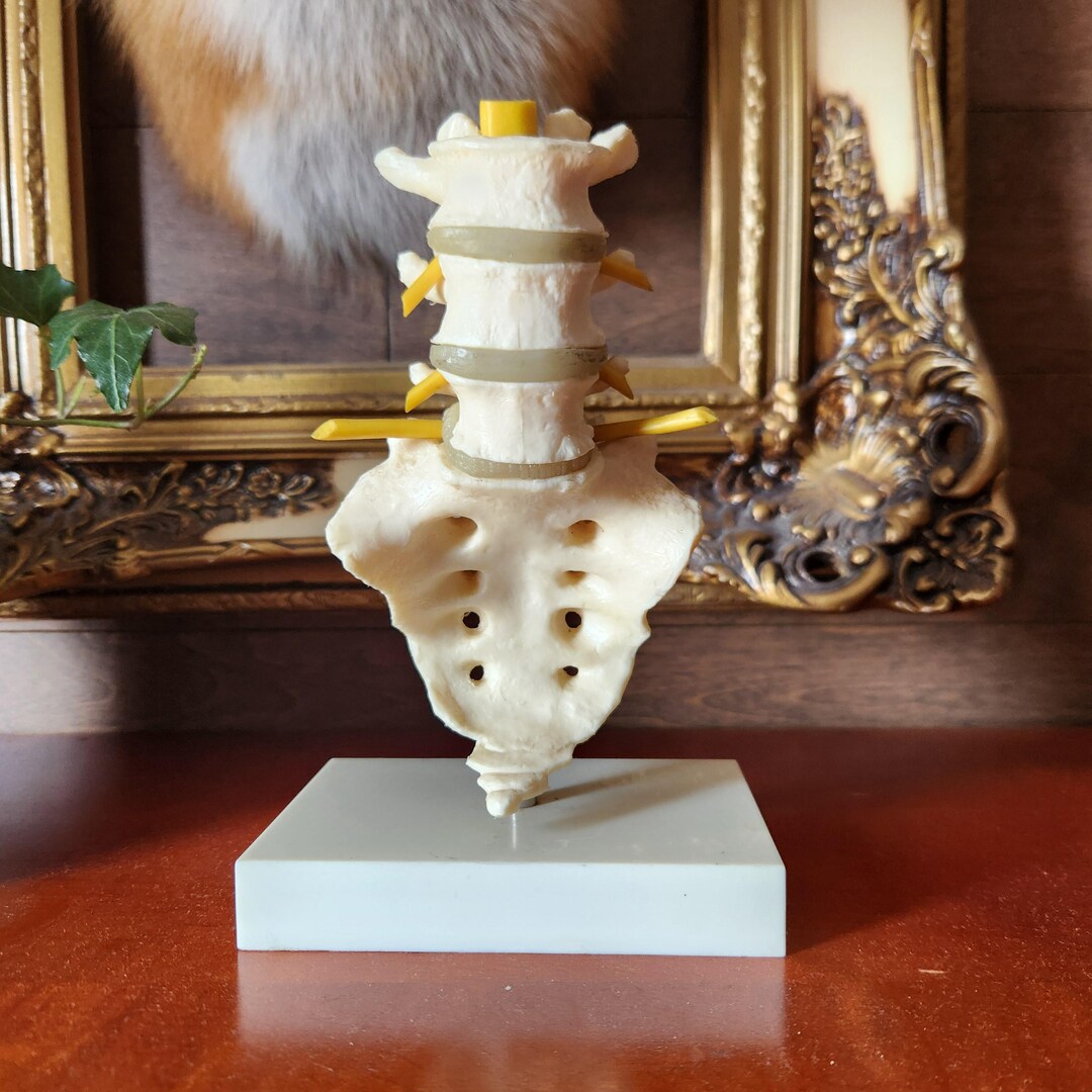 Vintage Model of Spine Lumbar Sacrum - Medical - Oddities - Curiosities ...