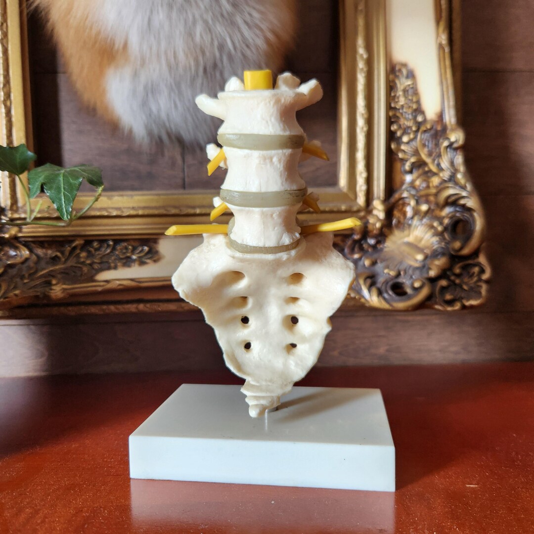Lower Spine and Sacrum Medical Model - Etsy