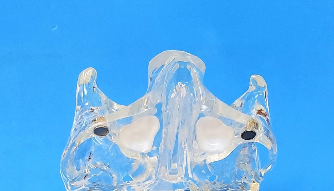 Sinuses Lift Dental Model Surgical Operative Presentation Dental - Etsy