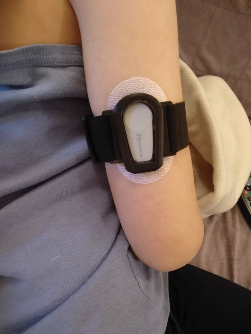 Dexcom Wear G6 Band - Etsy