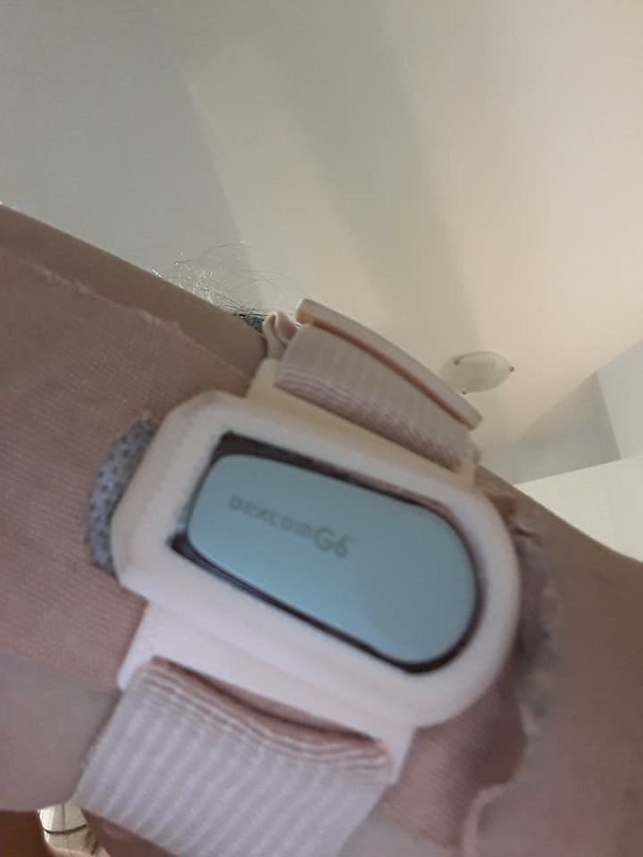 Dexcom Wear G6 Band - Etsy