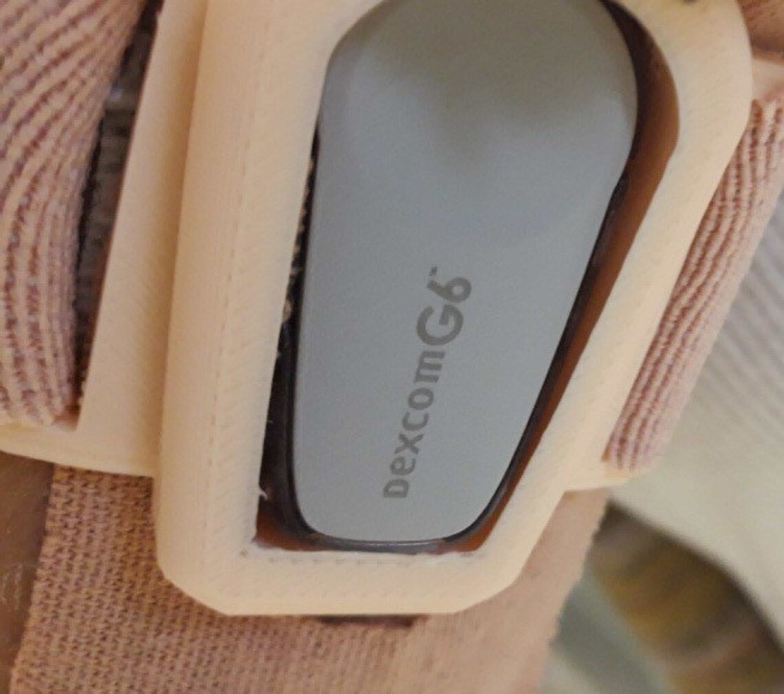 Dexcom Wear G6 Band - Etsy