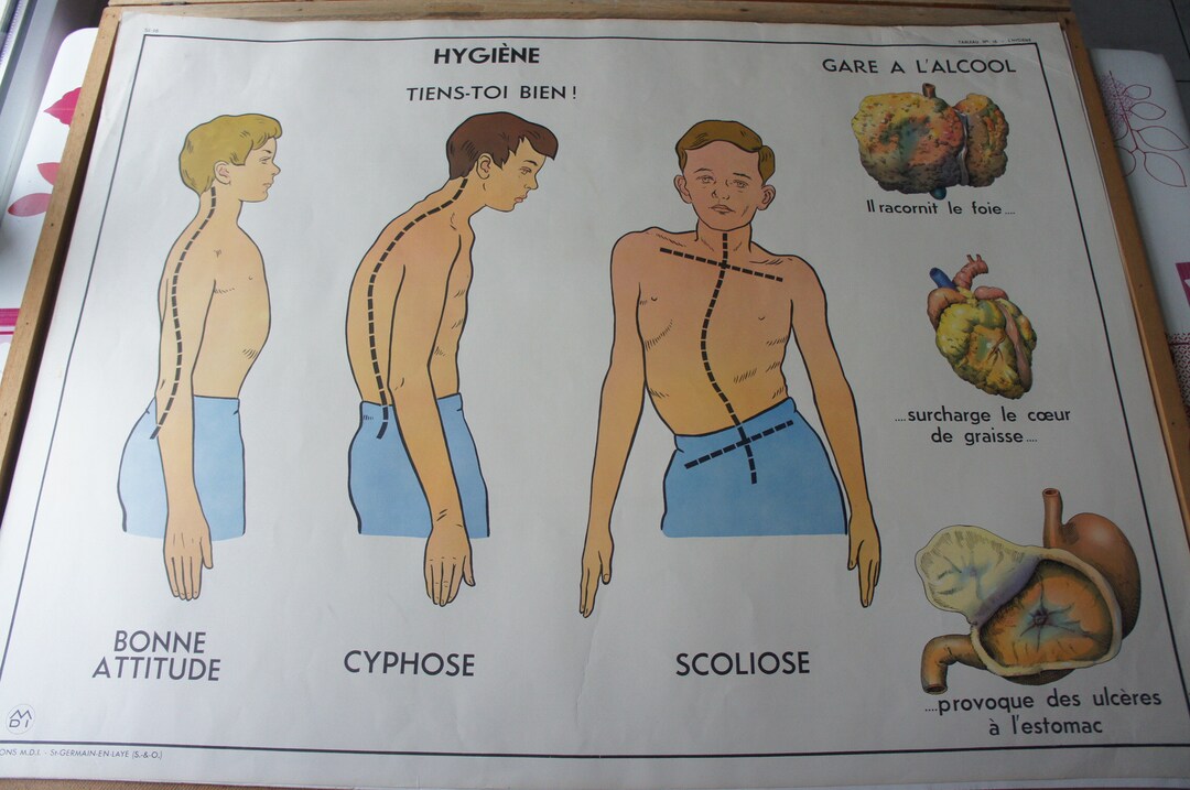 Old MDI SCHOOL POSTER Excretion Hygiene and First Aid 15 16 - Etsy