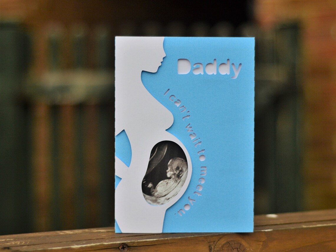Personalised Father's Day Card Baby Scan Card | Etsy UK