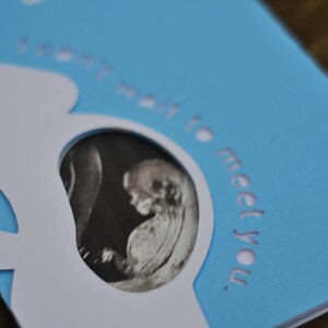 Personalised Father's Day Card Baby Scan Card - Etsy UK