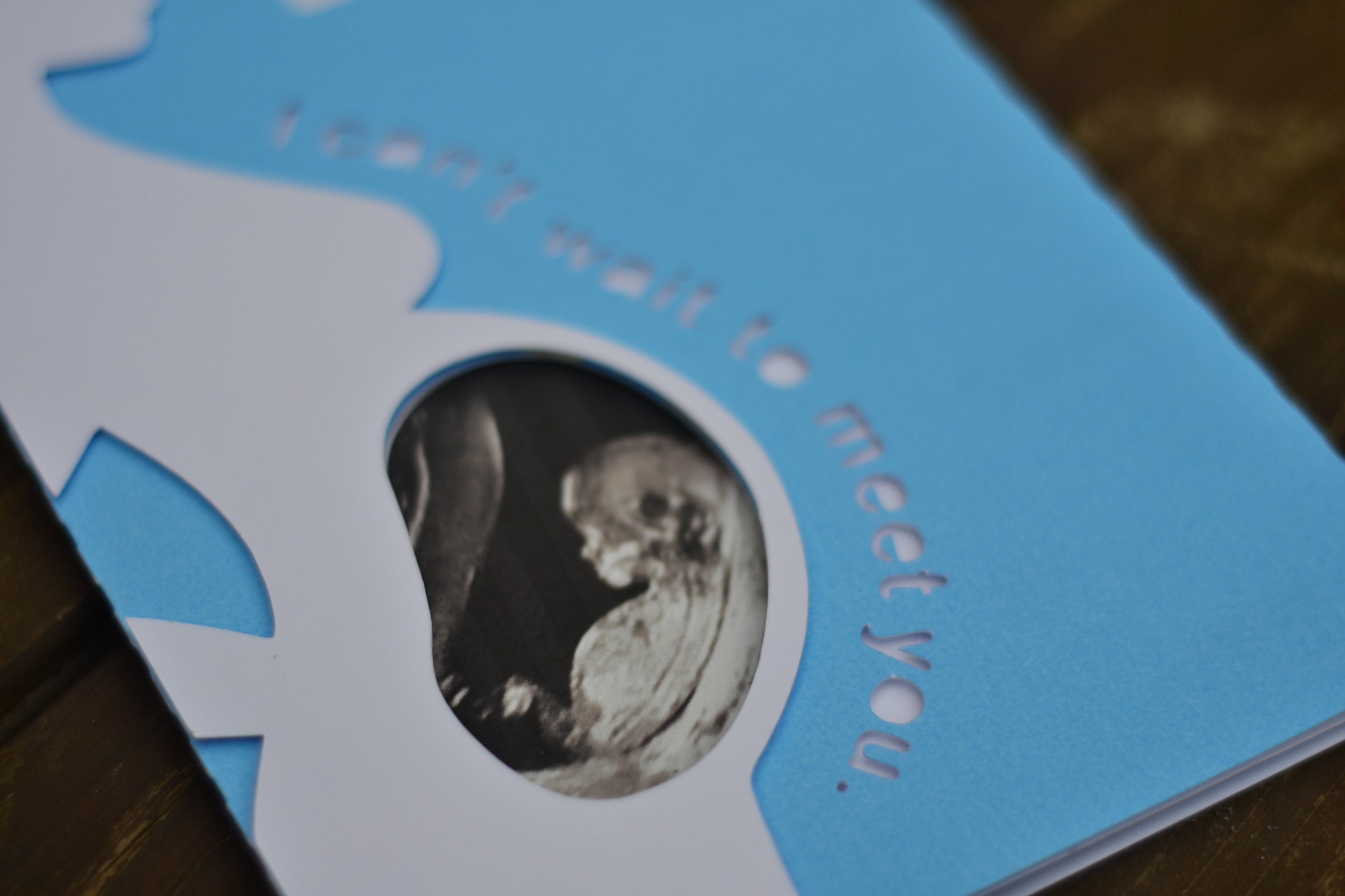 Personalised Father's Day Card Baby Scan Card | Etsy UK