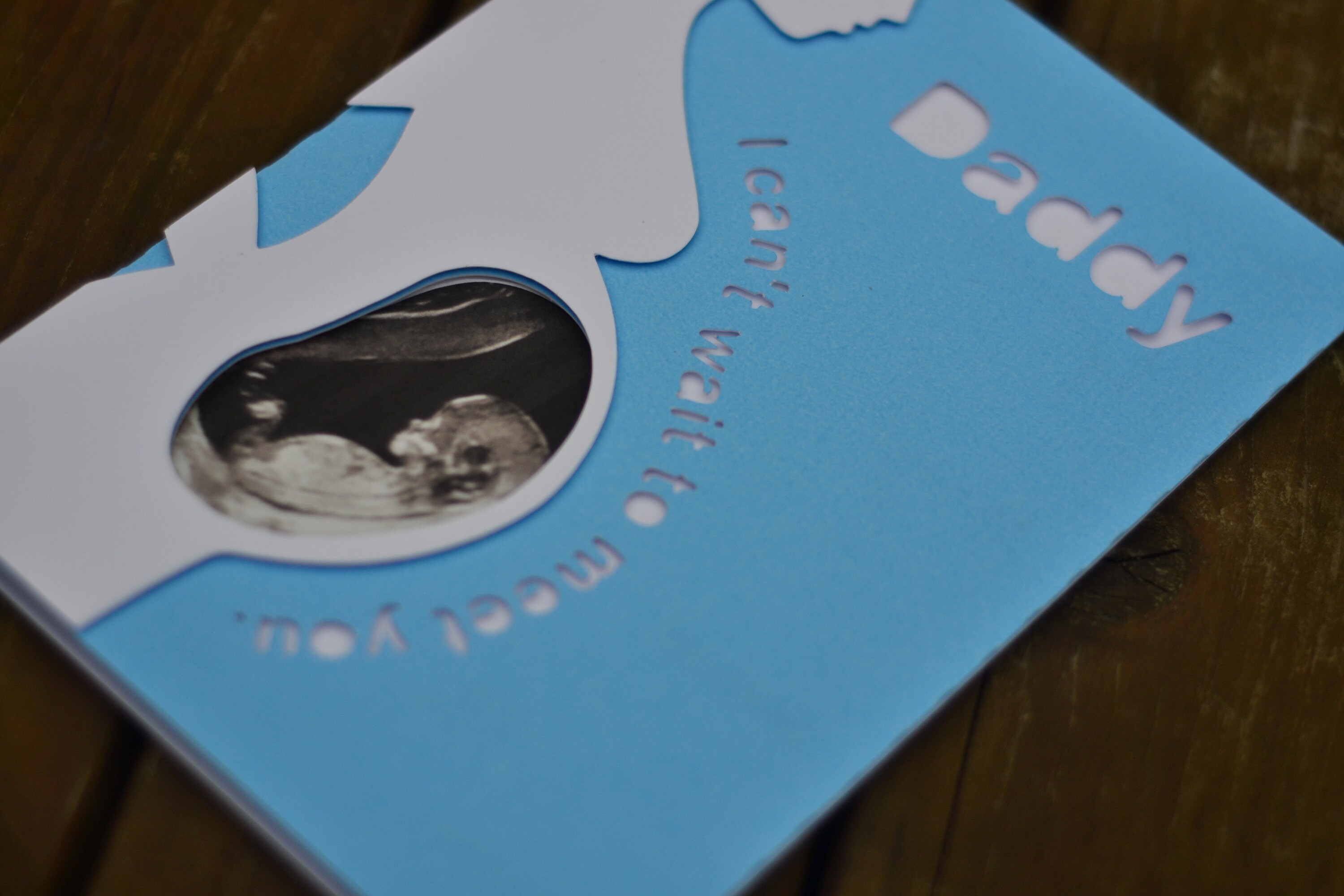 Personalised Father's Day Card Baby Scan Card | Etsy UK