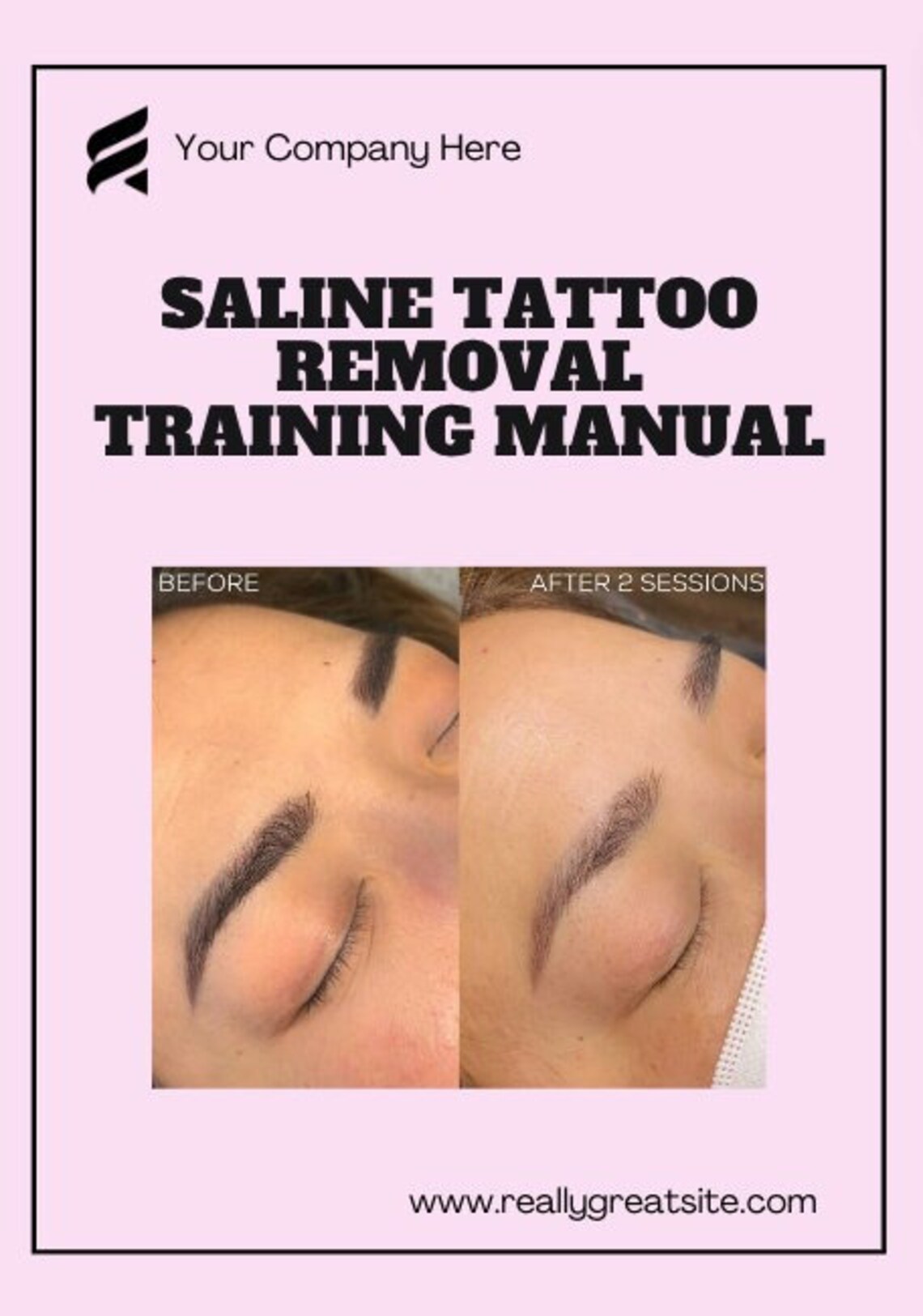 Editable Saline Tattoo Removal Training Manual + Consent and Aftercare Forms - Etsy