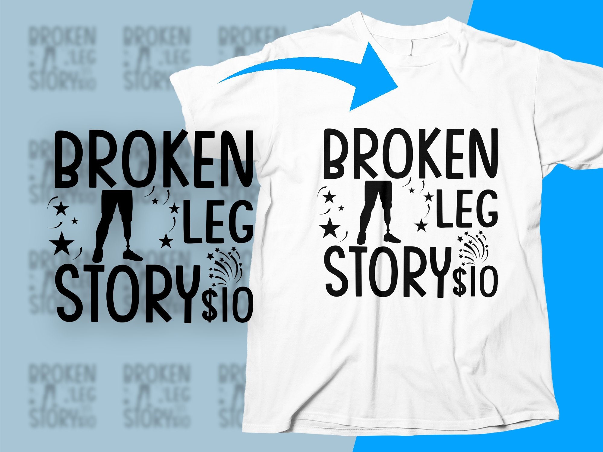Broken Leg Story Svg Png, Recovery Mode Svg, Broken Leg Svg, Injury Svg ...