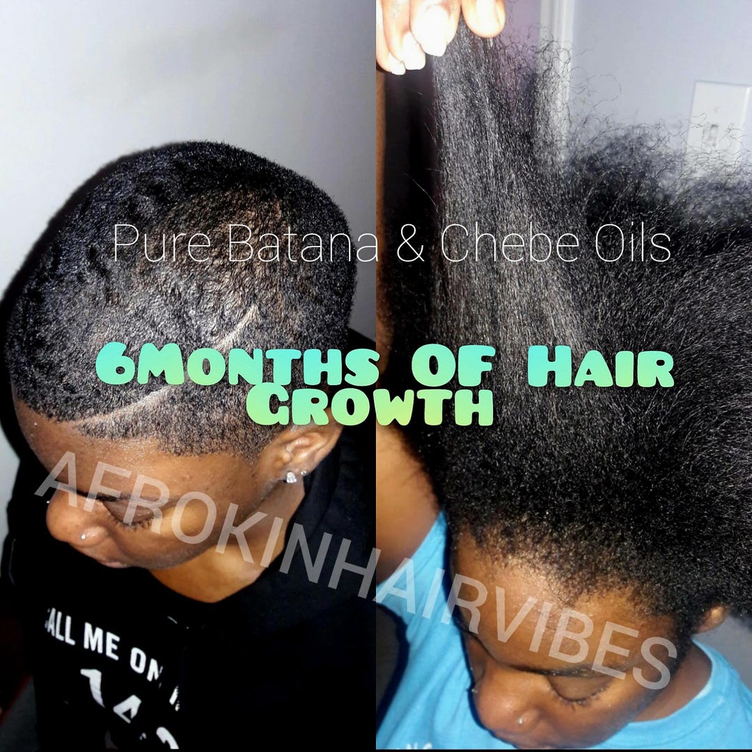 FAST HAIR GROWTH Alopecia Oil 100% Pure African Chebe, Batana Oil ...