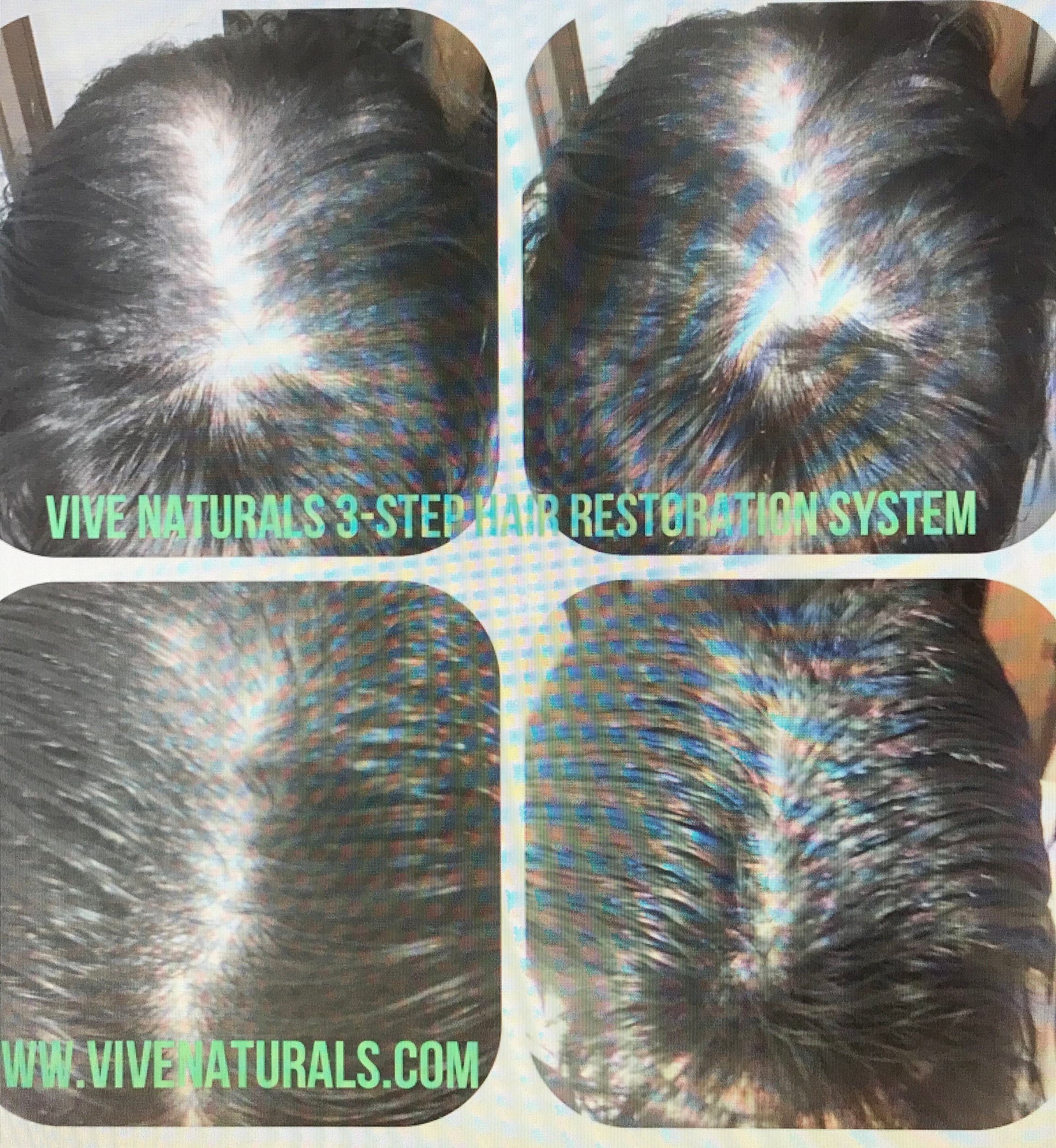 Vive Naturals Restoration Conditioner 8oz - Etsy