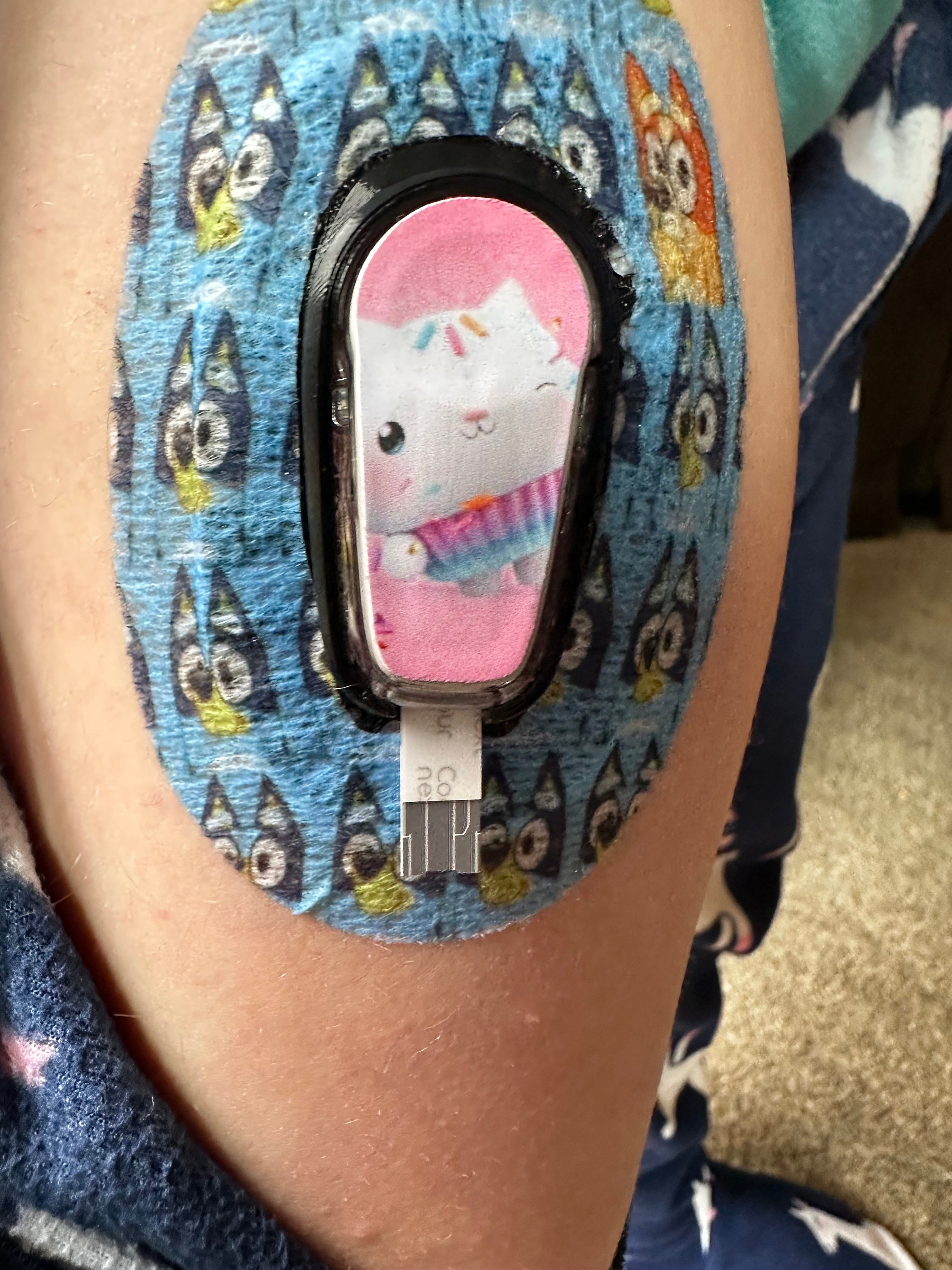 Dexcom G6 Grip Shield Lightweight TPU Restartable - Etsy