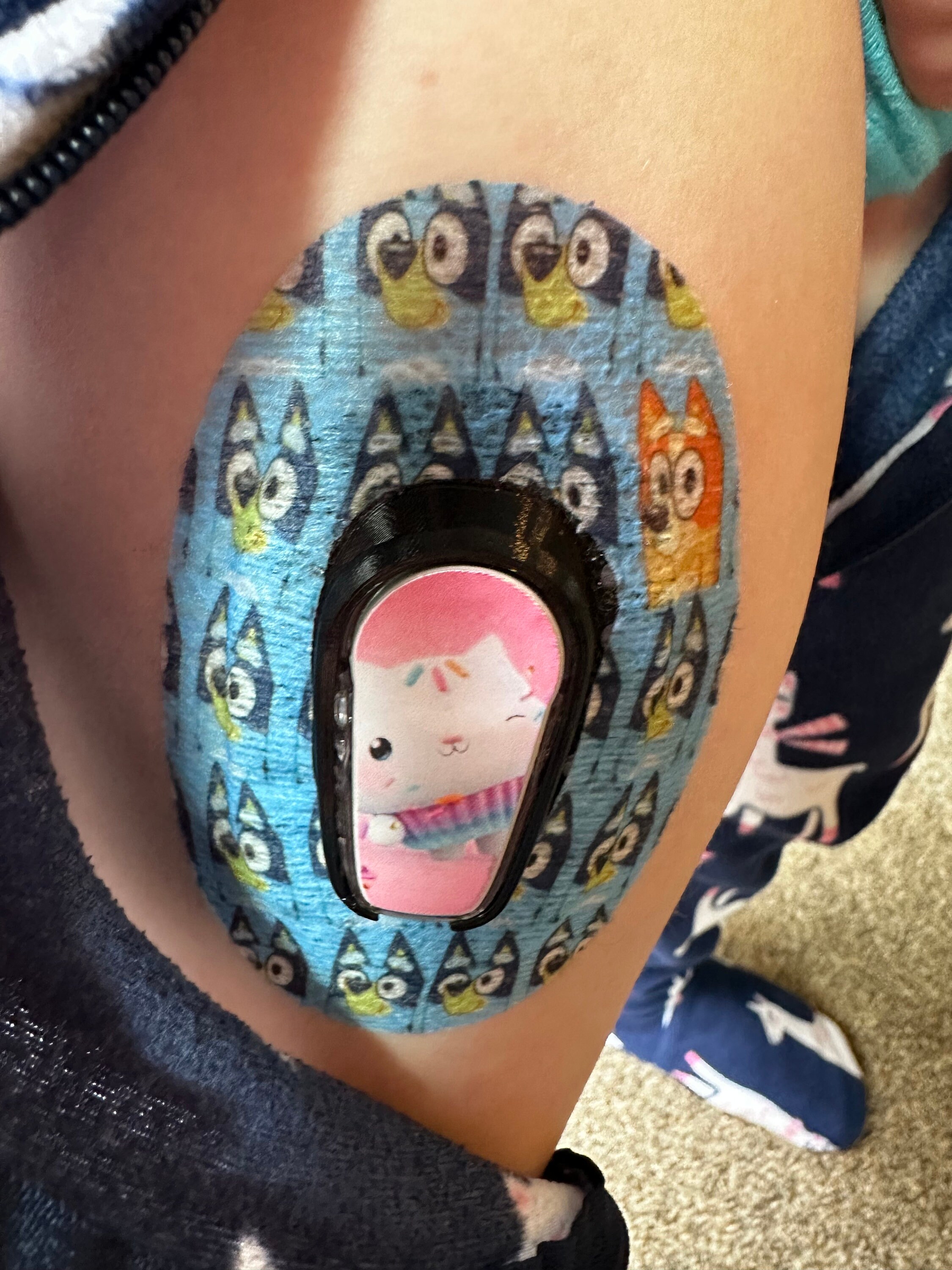 Dexcom G6 Grip Shield Lightweight TPU Restartable - Etsy