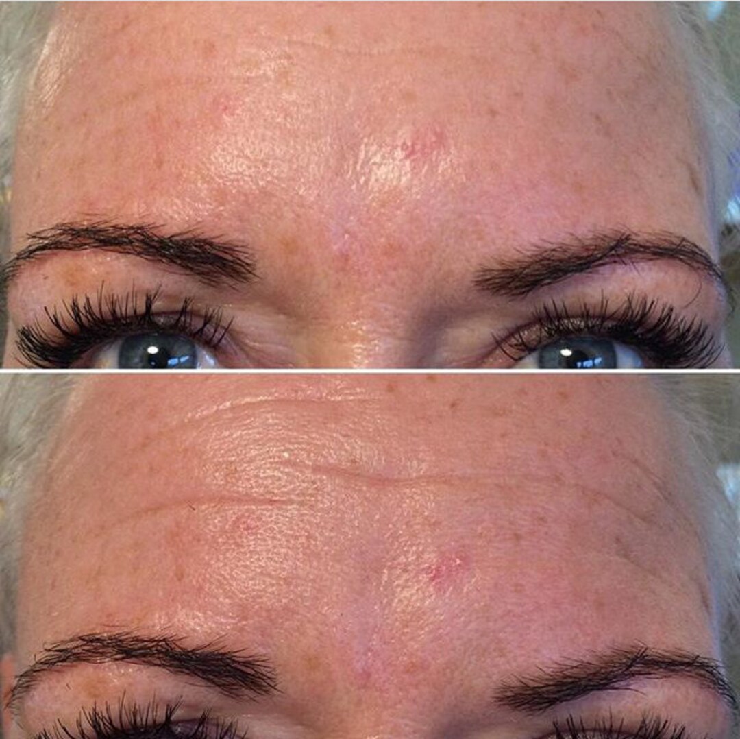 Wrinkle Erase Cream - Etsy