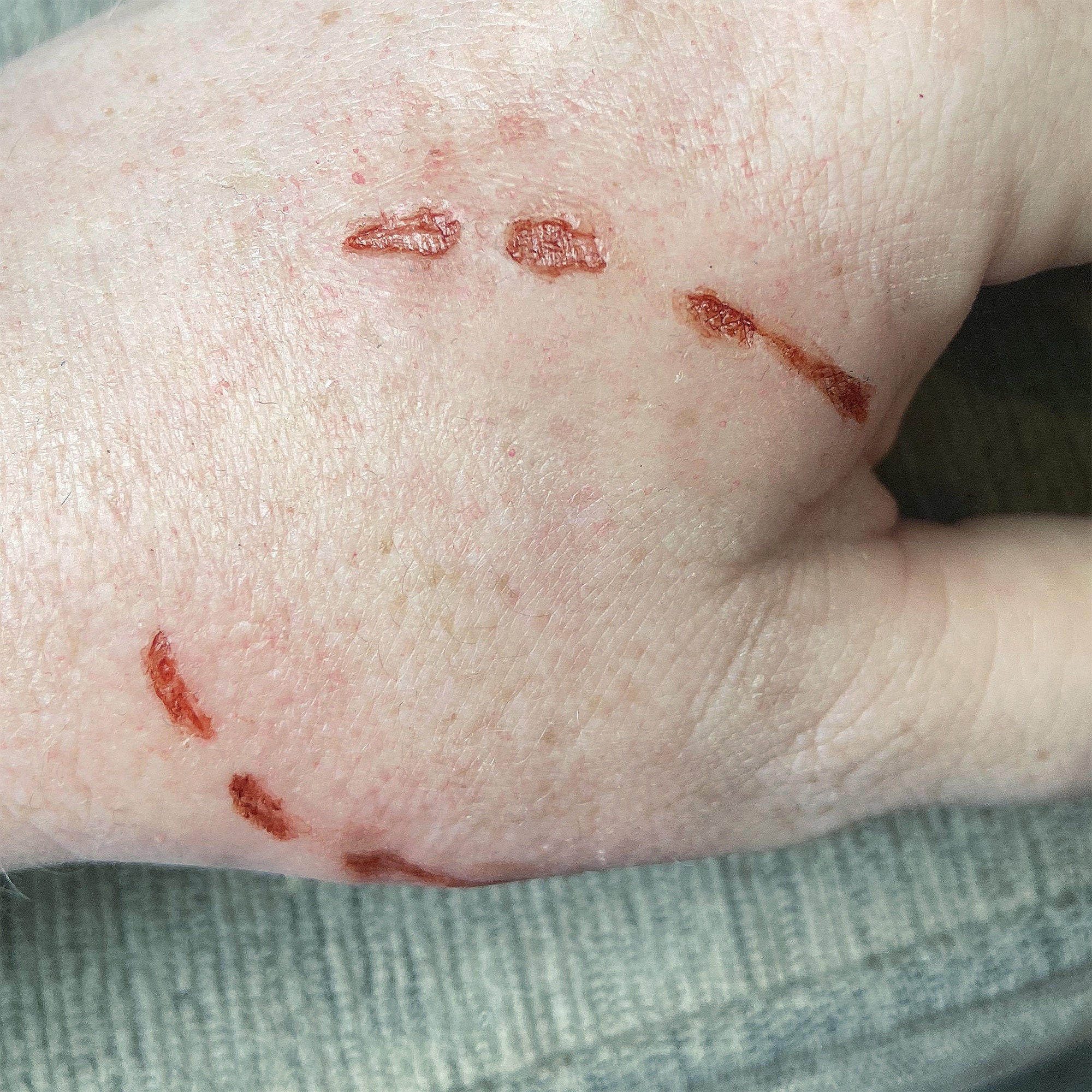 Accessories Costume Accessories Bite Wound Silicone Bondo Mould SFX ...