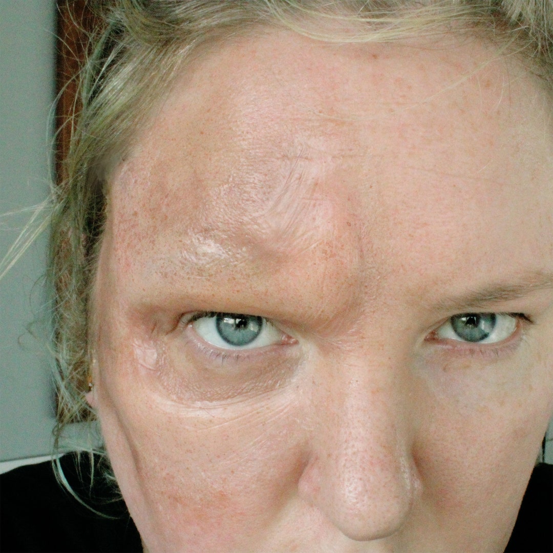 Skeletal Eye Socket Prosthetic // Encapsulated Silicone Appliance ...