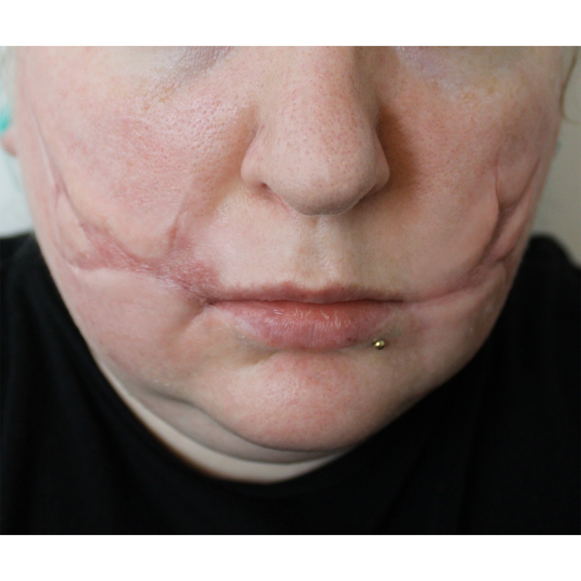 Joker Smile Ragged Mouth Cuts Prosthetic // Encapsulated Silicone ...