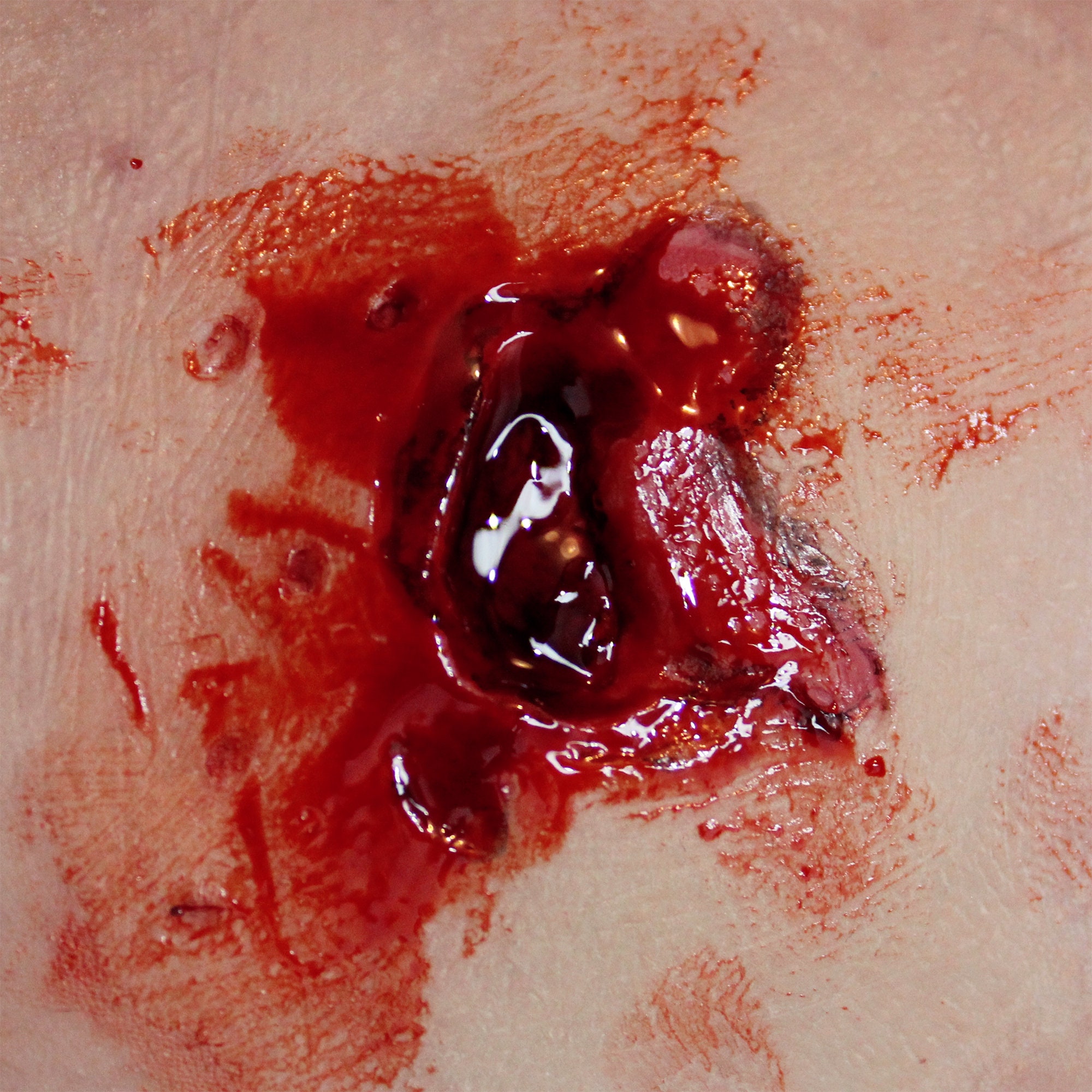 Real Gunshot Wound Leg