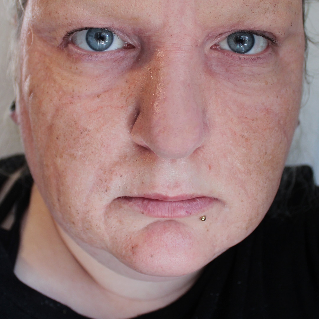 Old Age Cheek Prosthetics // Encapsulated Silicone Appliances // Ageing ...