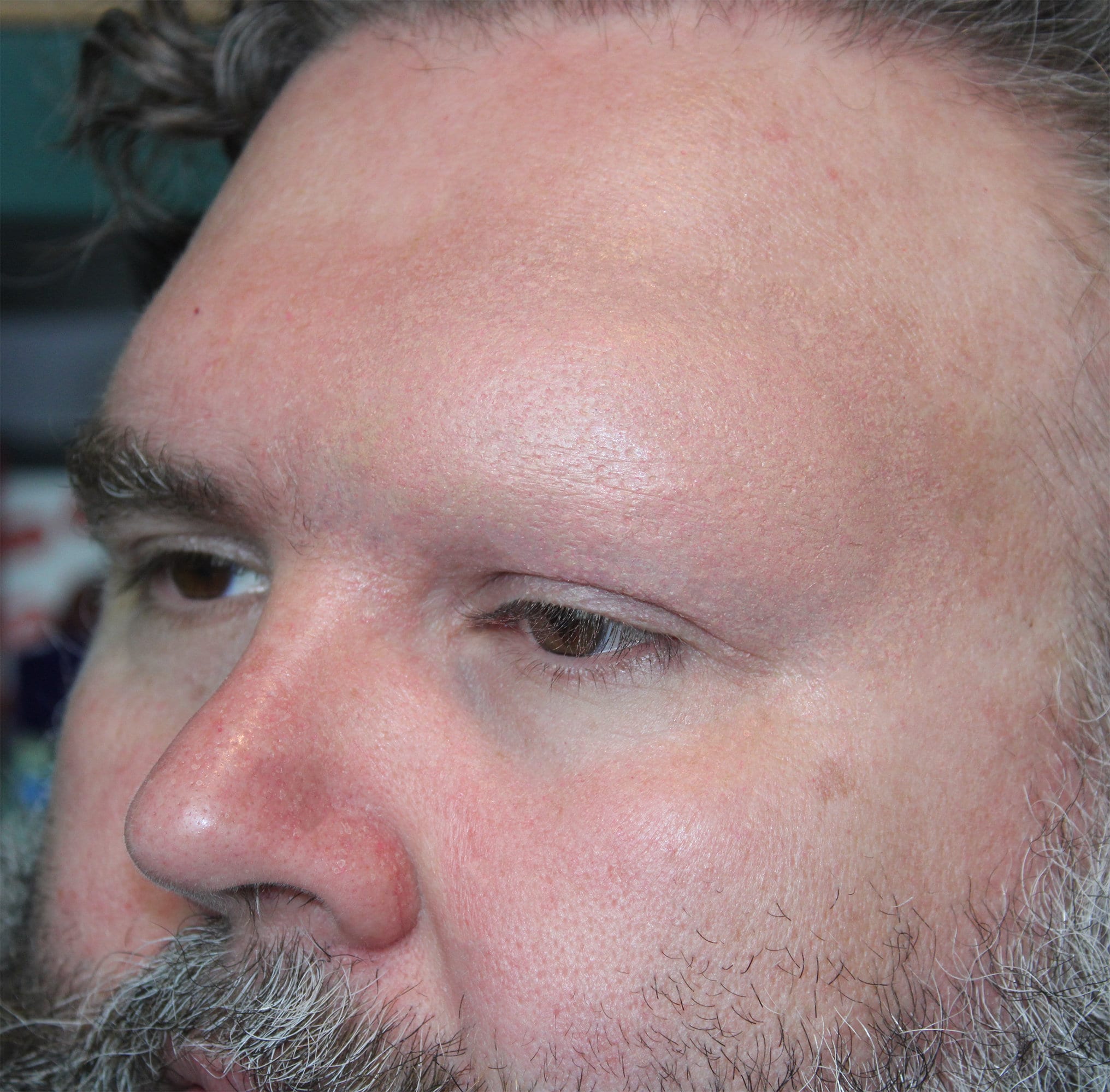 Large Eyebrow Blockers Brow Covers // Encapsulated Silicone Prosthetic ...