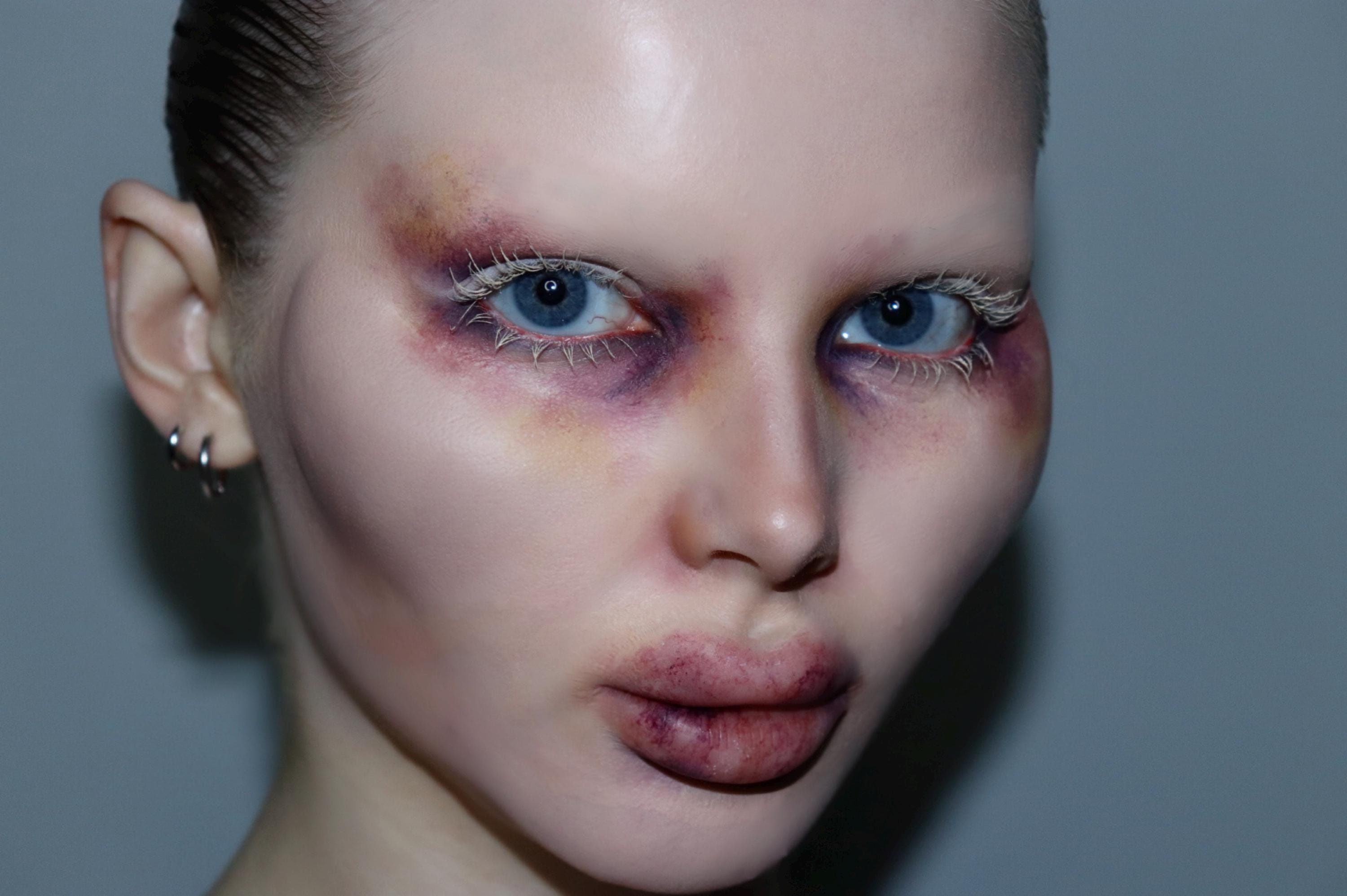 Makeup For After Plastic Surgery