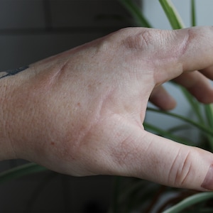 Indented Scar Moulds 2 // Six Silicone Wound Moulds for Bondo // SFX ...