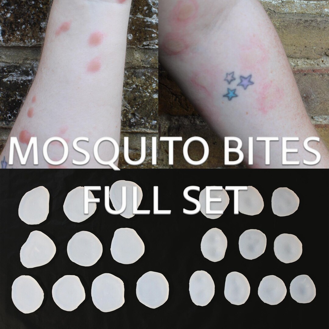 20 Mosquito Bites Stage 1 and 2 Silicone Bondo Mould for Professional ...